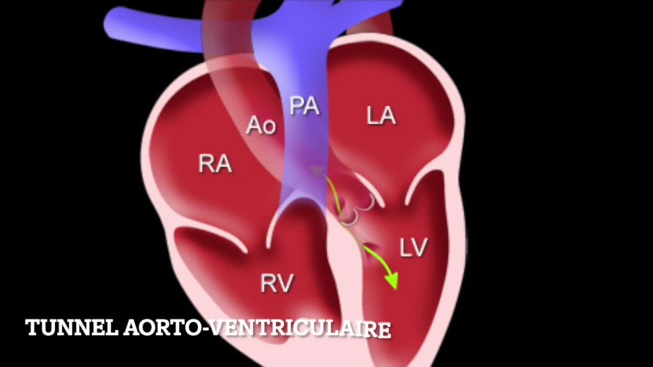 Centre de Référence M3C Malformations Cardiaques Congénitales Complexes