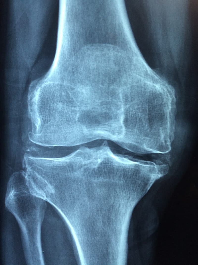 Proyecciones básicas de rodilla - Guía virtual para técnicos