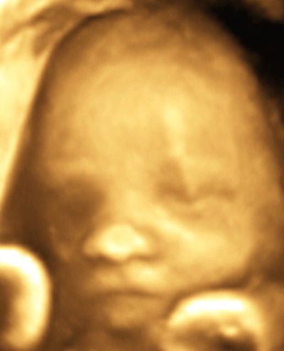 Ecografia 3D (tridimensionale) e 4D (tridimensionale in tempo reale)