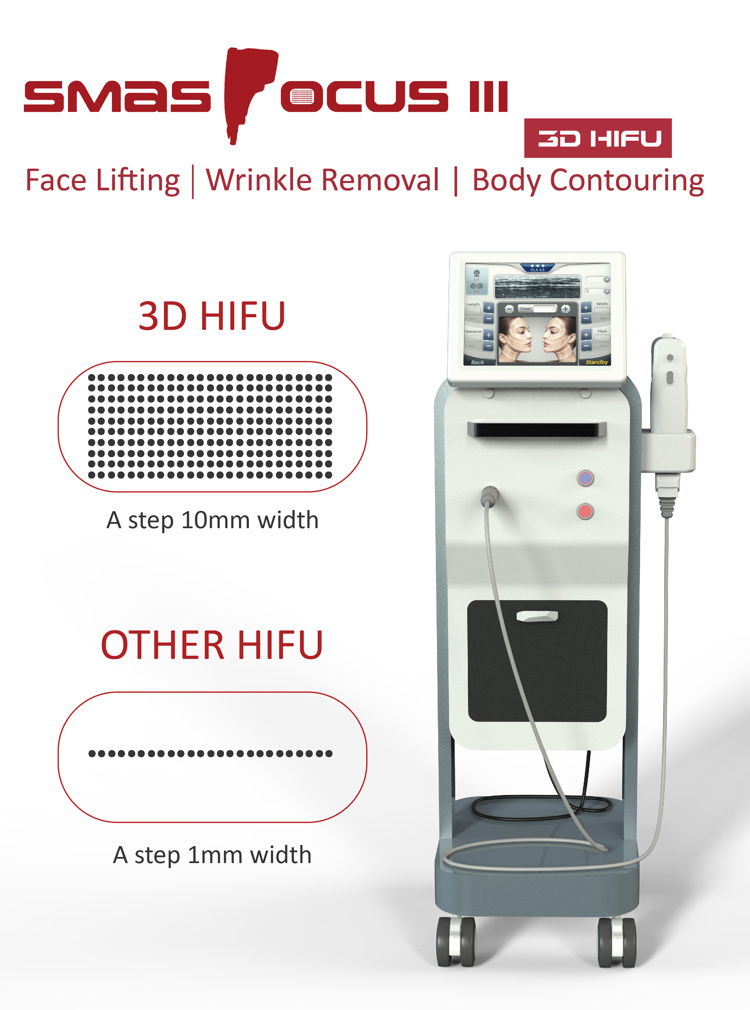 SMAS Focus 3D HIFU - Tegemed