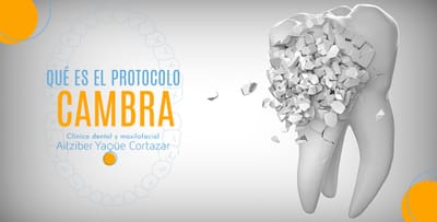 SISTEMA CAMBRA - clinica dental Don Molar