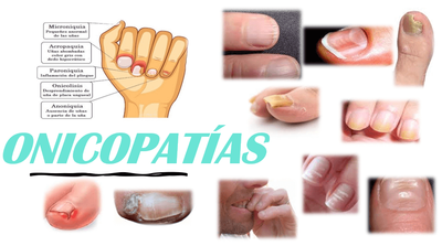 ONICOPATÍAS - MANICURA Y PEDICURA J.G.A