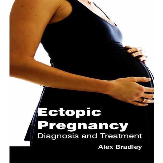 Ectopic Pregnancy Diagnosis And Treatment