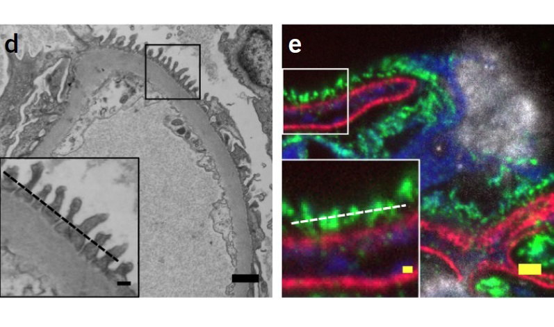 Nanoscale imaging of clinical specimens using pathology-optimized ...