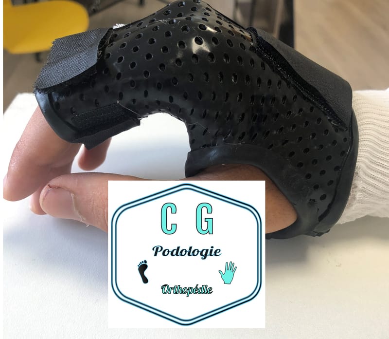 Orthèses thermoformées - CG PODOLOGIE ORTHOPEDIE