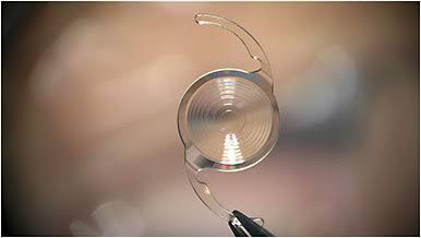 WHICH LENS IS BEST SUITABLE AFTER CATARACT SURGERY? - DR MAHAVIR DATTANI