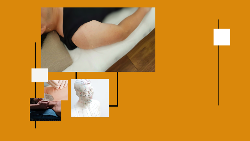 Sunshine Acupuncture Clinic 曜光跌打醫館 - Traditional Chinese Medicine ...